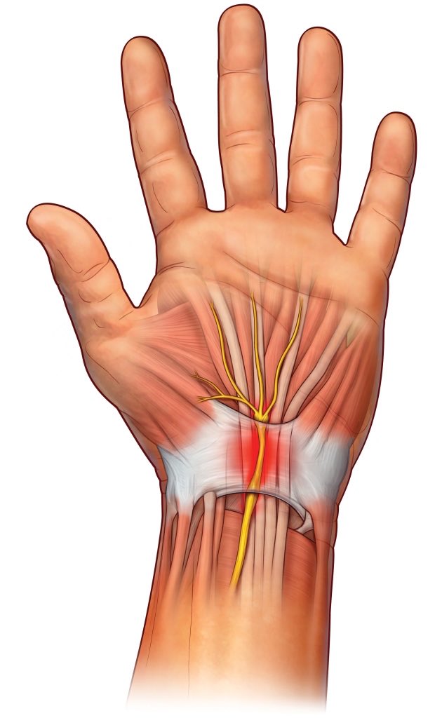 Bolesti ruky a zápěstí – rehabilitace-dobesova.cz